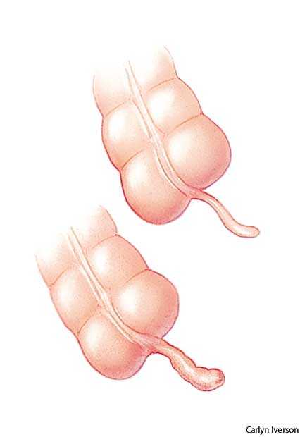 Appendix Dictionary Definition Appendix Defined